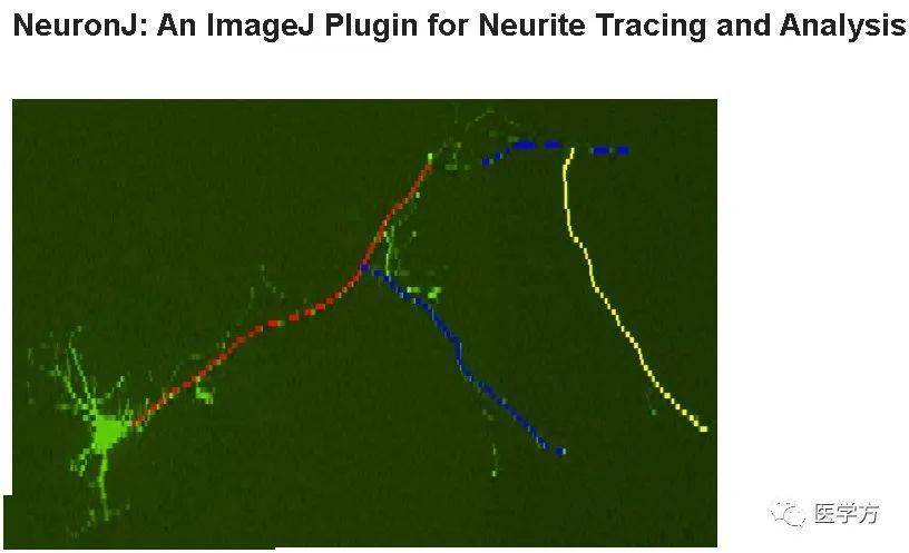 老司机带你解锁ImageJ长度分析_Edit->