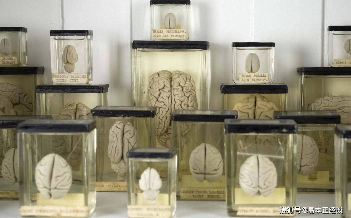 大脑表面为什么有这么多褶皱？_动物