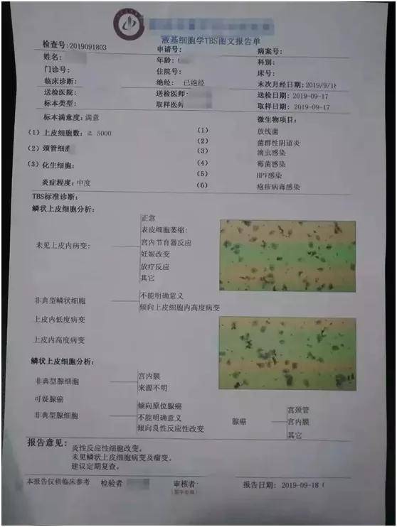 所有女性都要做的TCT检查是什么？做TCT检查前要注意5点_宫颈