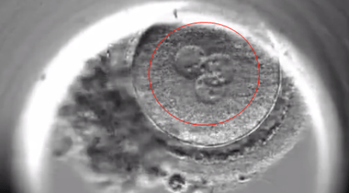 胚胎受精解读：2PN、0PN、1PN有什区别？_精子