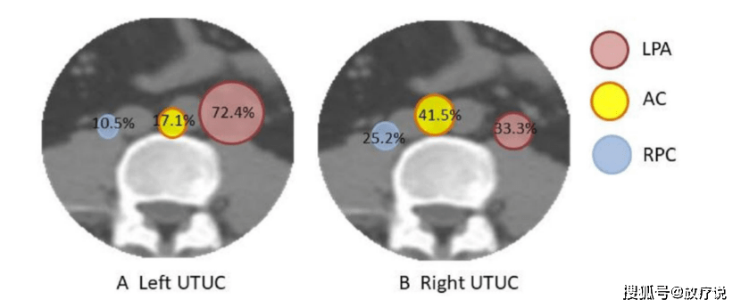新的突破 | 高献书教授团队：研究证实UTUC术后复发模式及术后放疗价值！_肿瘤_辅助_患者