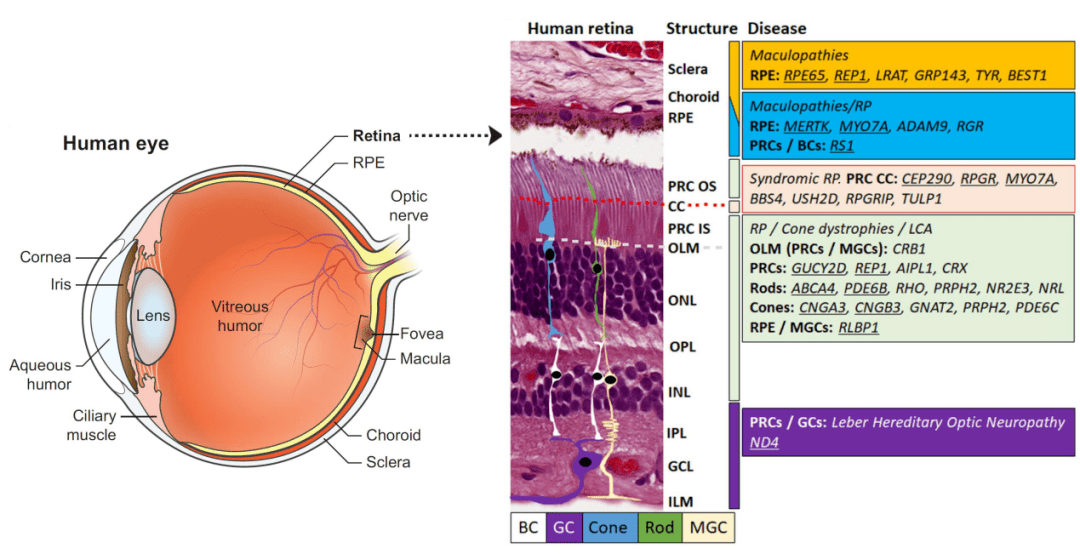 AAV基因治疗在眼科疾病研究中的应用及常见注射方式_视网膜_麻醉_病毒