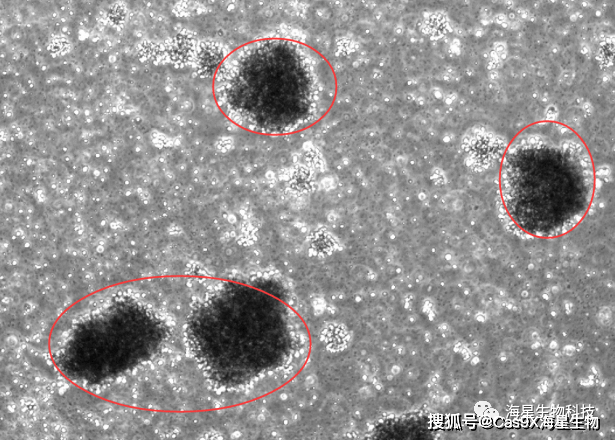 人T淋巴细胞白血病细胞(Jurkat)培养要点_培养基_建议_密度