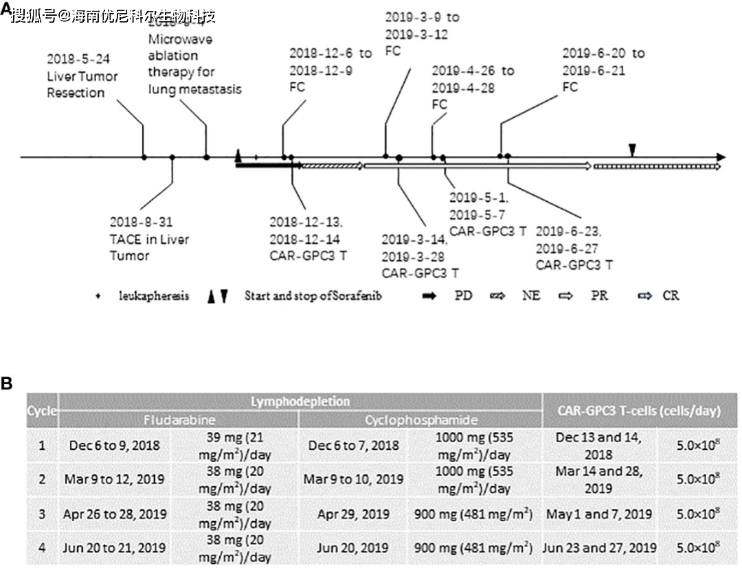 肝癌治疗迎来新突破！靶向GPC3的Car-T联合疗法让晚期肝癌患者病灶完全消失_细胞_索拉非尼_周期
