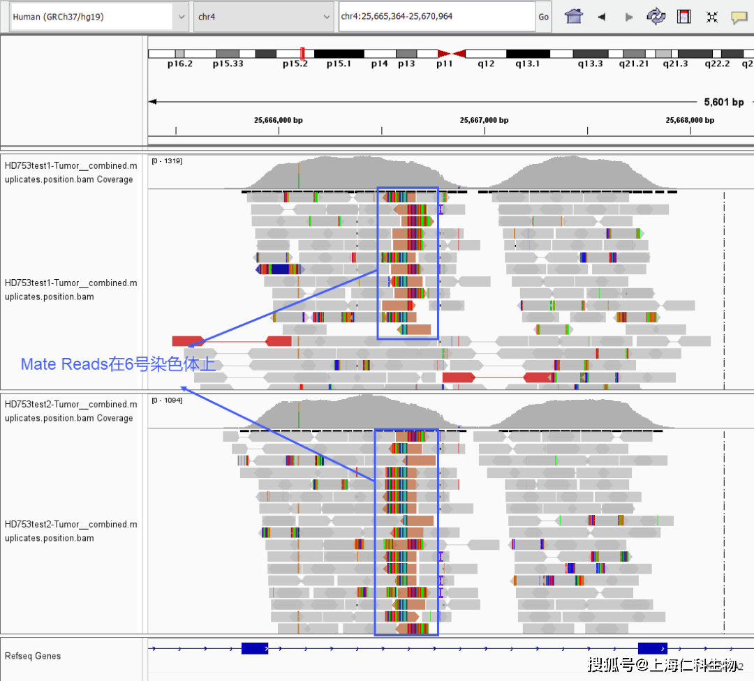 IGV快速上手指南（四）——查看基因融合_reads_位置_进行