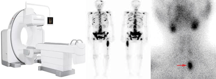 是时候搞清楚ECT、ETC、ECG了！_检查