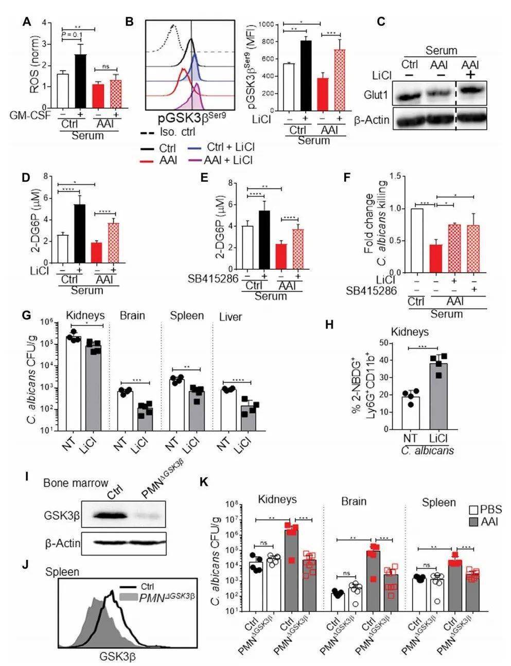 Sci Trans Med：恢复葡萄糖摄取可挽救肾脏病小鼠中性粒细胞功能障碍并保护其免受真菌感染_患者