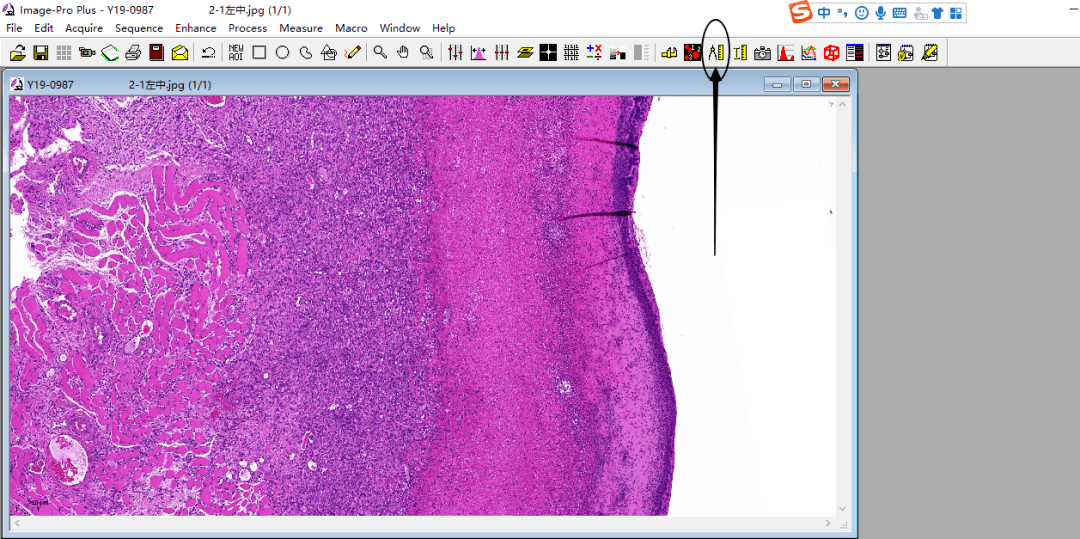 5分钟学会Image Pro Plus测量组织平均厚度_Dist
