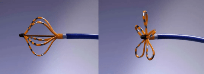 终如愿！波科宣布收购PFA技术执牛耳者Farapulse _导管