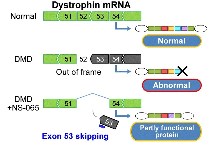 速递 | DMD疗法长期疗效积极，在中国已递交监管申请_治疗