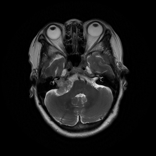 【重磅医迅】我院医学影像科引进使用美国GE1.5T超导磁共振（MRI）设备！_成像