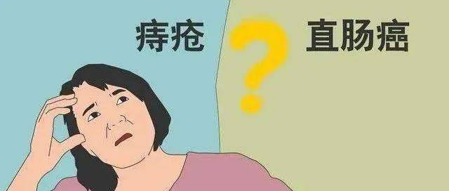 痔疮与直肠癌如何辨别?患者粪便恶性肿瘤