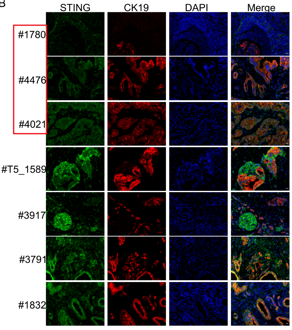 递送STING-mRNA-LNP，激活干扰素信号通路，火烧冷肿瘤。_细胞_治疗_癌症