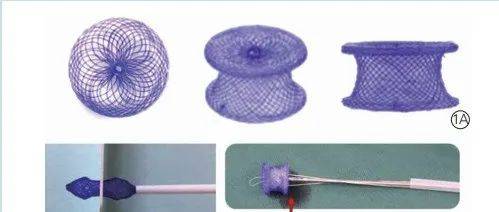 心血管介入治疗的里程碑！阜外医院潘湘斌完全可降解室缺封堵器述评_MemoSorb_结构性_技术