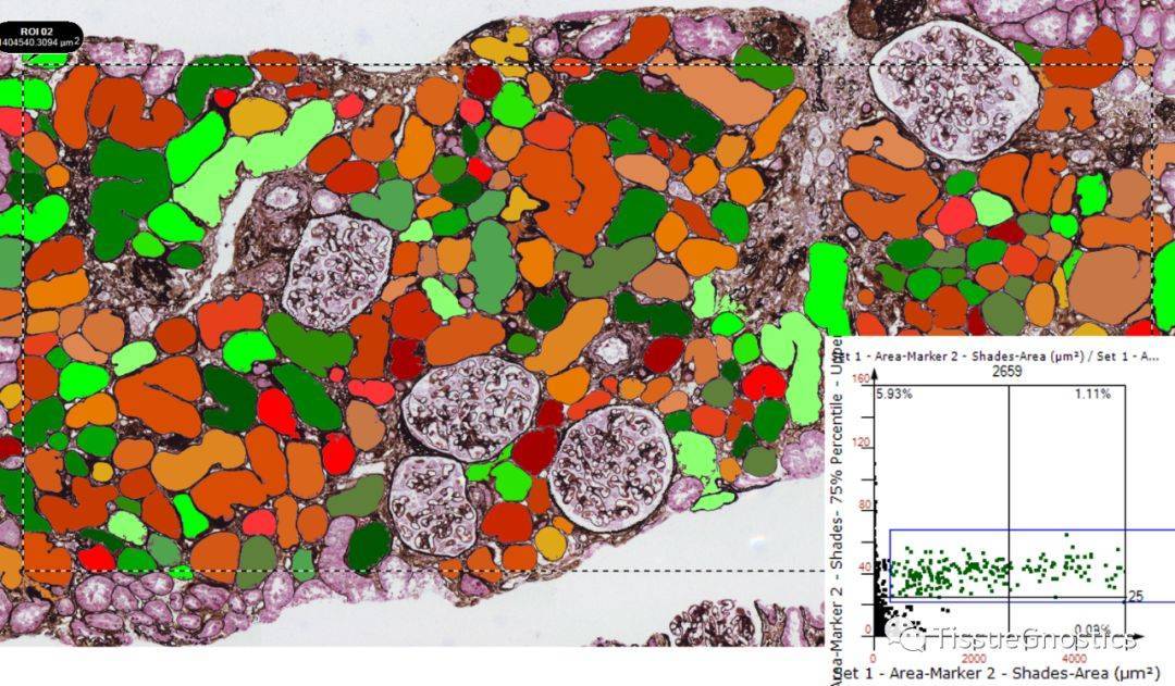 肾脏活检组织PASM染色定量分析实例_识别_进行_实验