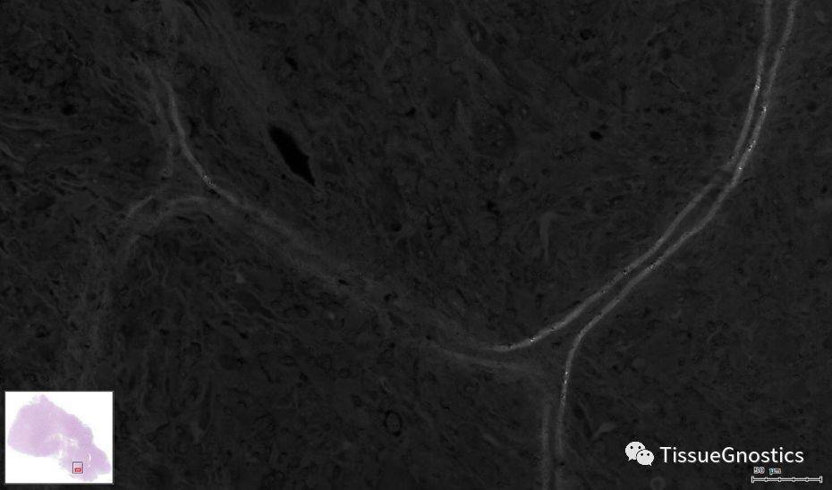 TissueGnostics公司H&E染色样本定量分析实例_识别_苏木_细胞核