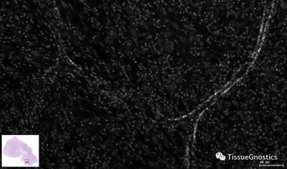 TissueGnostics公司H&E染色样本定量分析实例_识别_苏木_细胞核