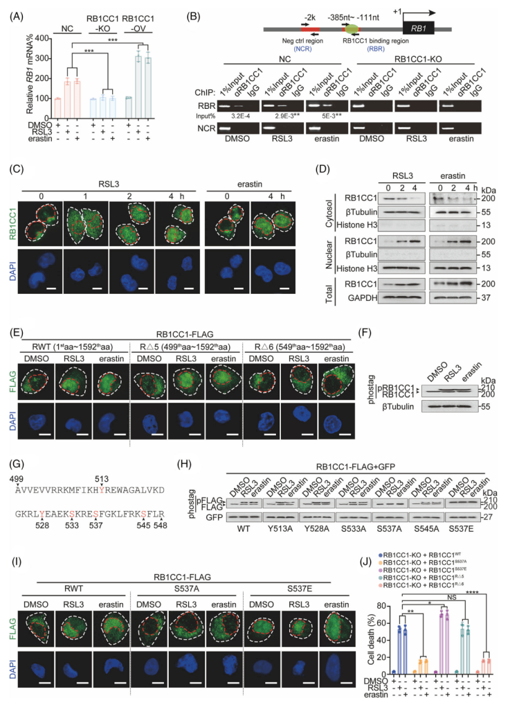 肿瘤细胞通过RB1CC1介导的转录重编程对铁死亡敏感_诱导_相关因素_治疗