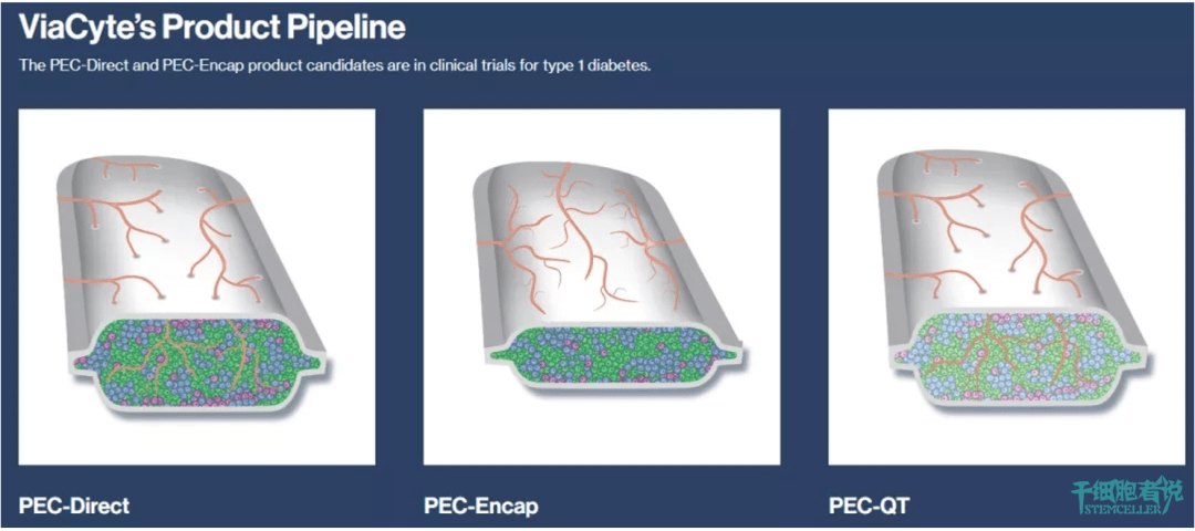 重磅：全球干细胞治疗糖尿病临床试验现状梳理！_移植_胰岛_免疫