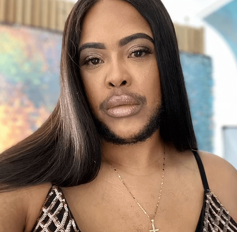 发声 | 女子患有荷尔蒙疾病毛发疯长，斗争几十年后放弃剃毛：实在太麻烦了！_LaRae_女性_问题