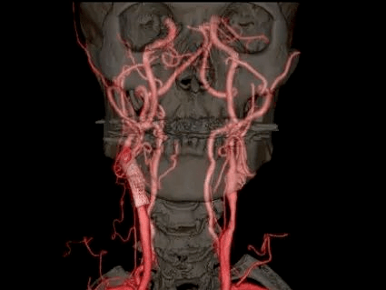 疾病诊断又添“侦察兵”！Optima CT620上线-搜狐大视野-搜狐新闻