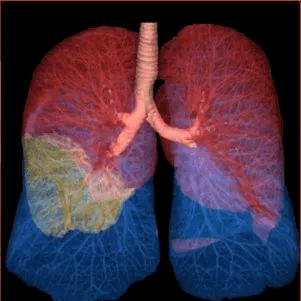 疾病诊断又添“侦察兵”！Optima CT620上线-搜狐大视野-搜狐新闻
