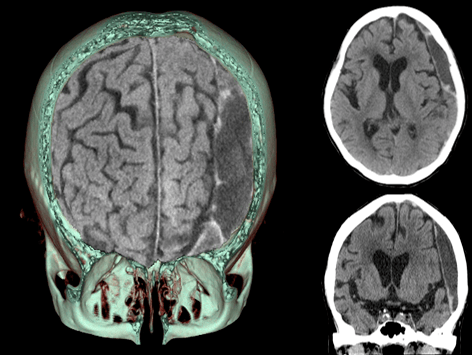 疾病诊断又添“侦察兵”！Optima CT620上线-搜狐大视野-搜狐新闻