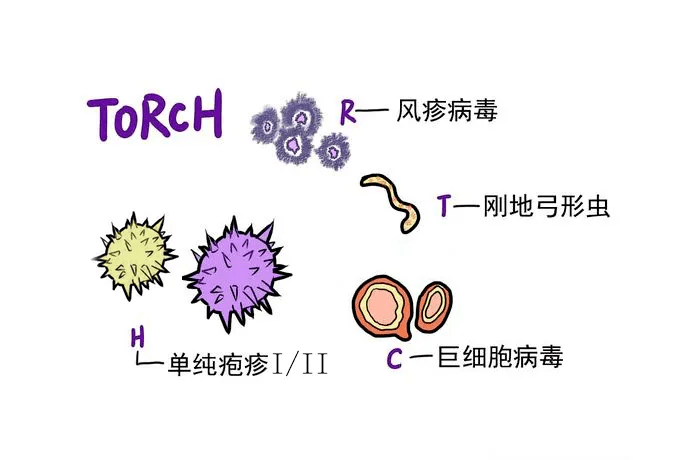 准孕妇们，你进行TORCH检测了吗？_建议_胎儿_评估风险