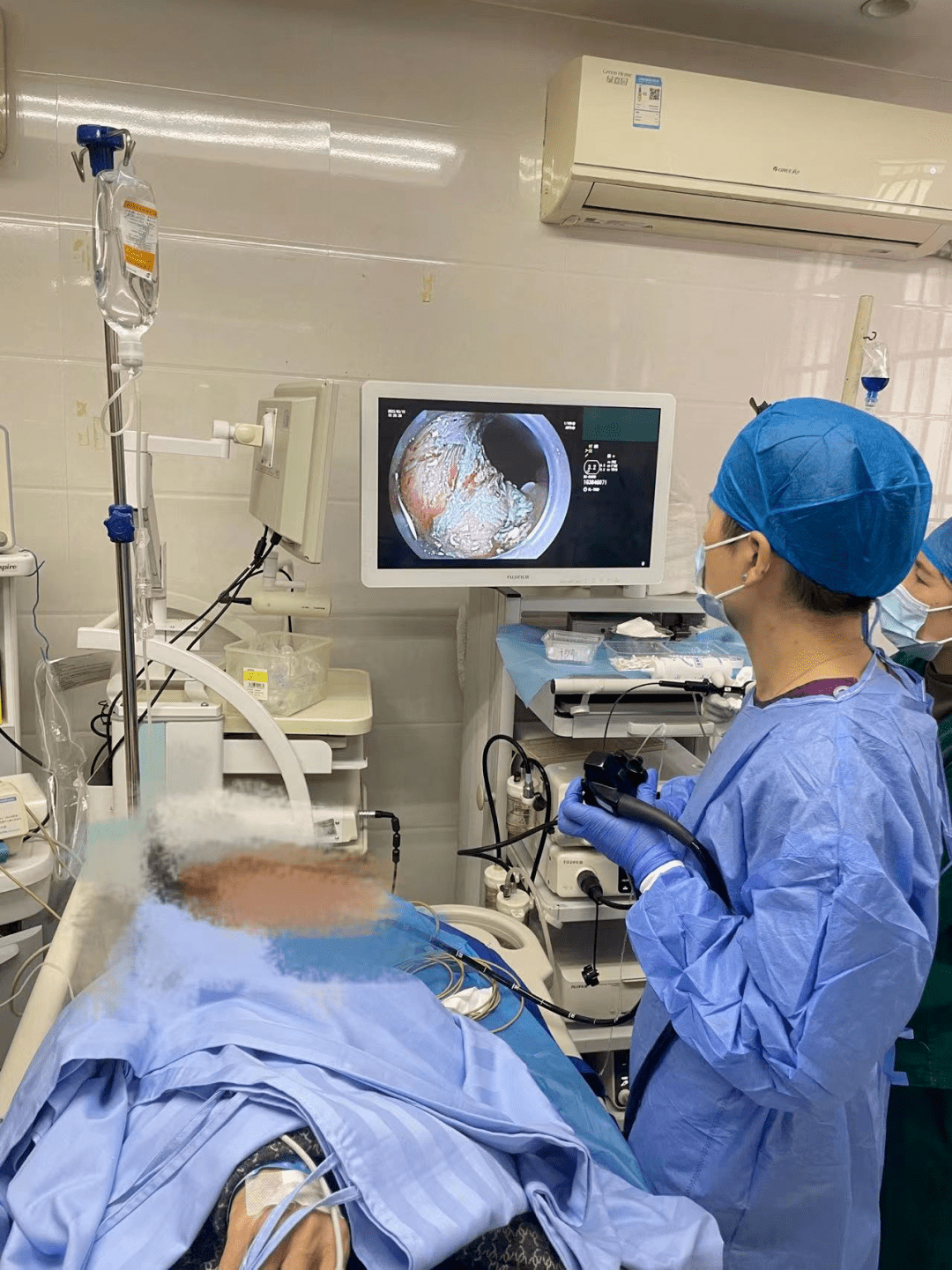 【技术提升】南安市医院完成首例内镜黏膜下隧道肿瘤切除术_手术_治疗_肿物