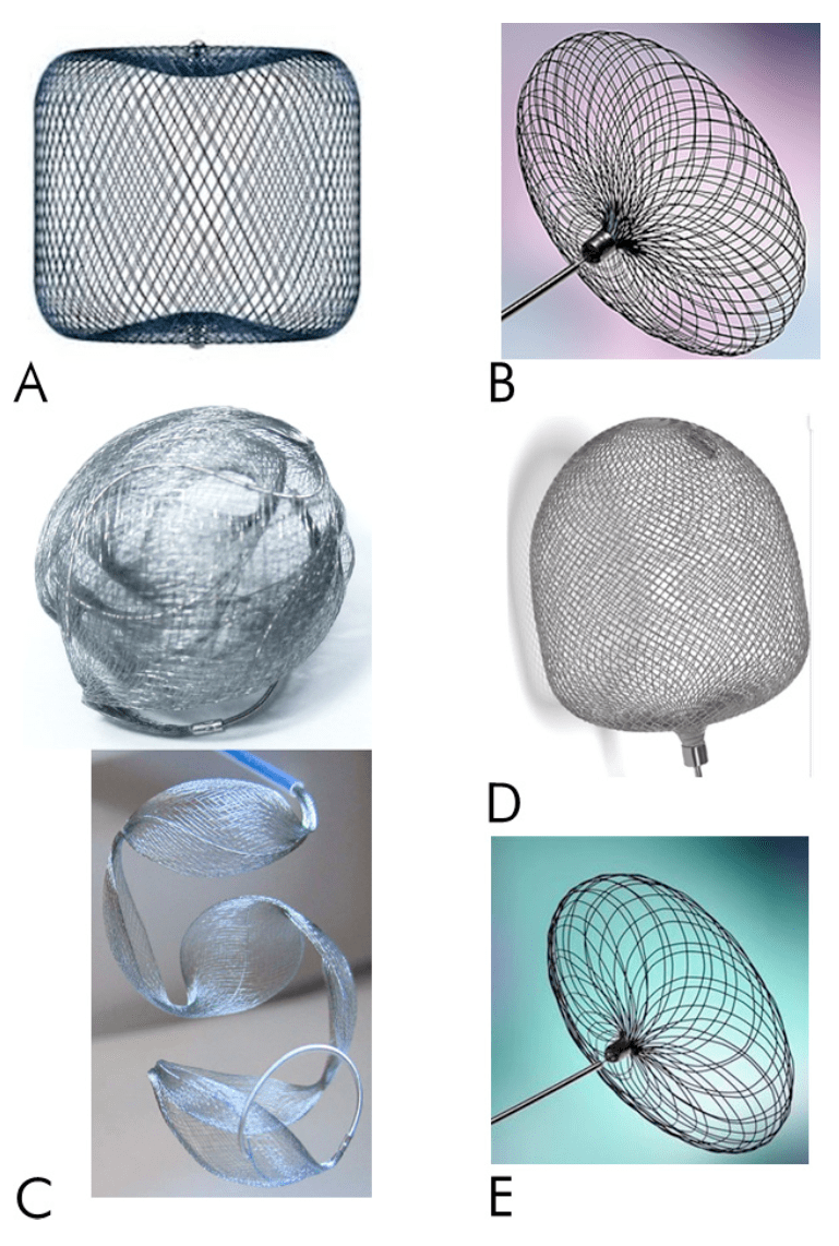 一文读懂丨瘤内扰流装置的简要回顾_治疗_系统_器械