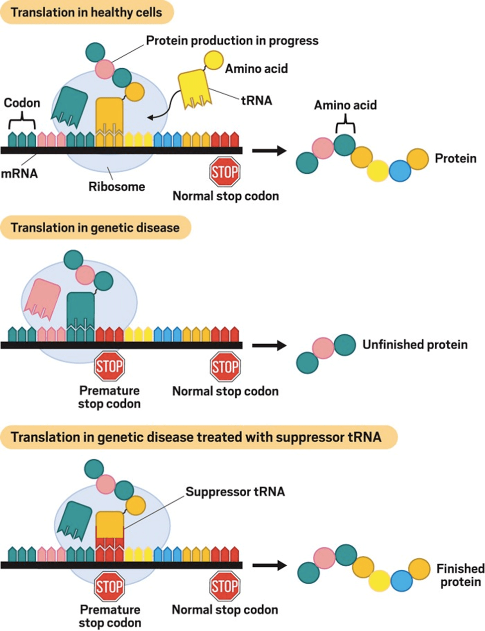 了解tRNA基因治疗_疗法_研究_Tevard